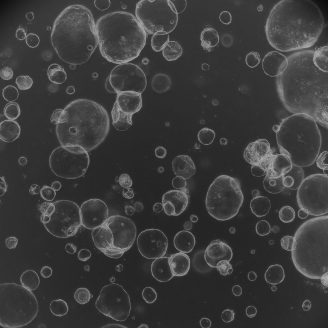 Exploring and Mapping Biological Complexity: Spatial Proteomics as ...