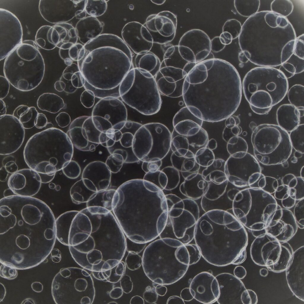 Cholangiocarcinoma Organoid - Lambda Biologics