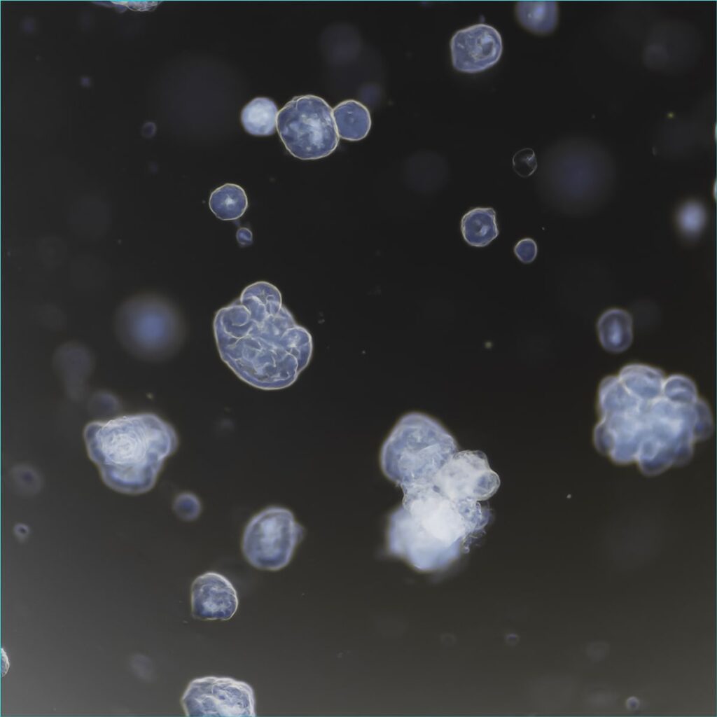 Endometrial Cancer Organoid - Lambda Biologics
