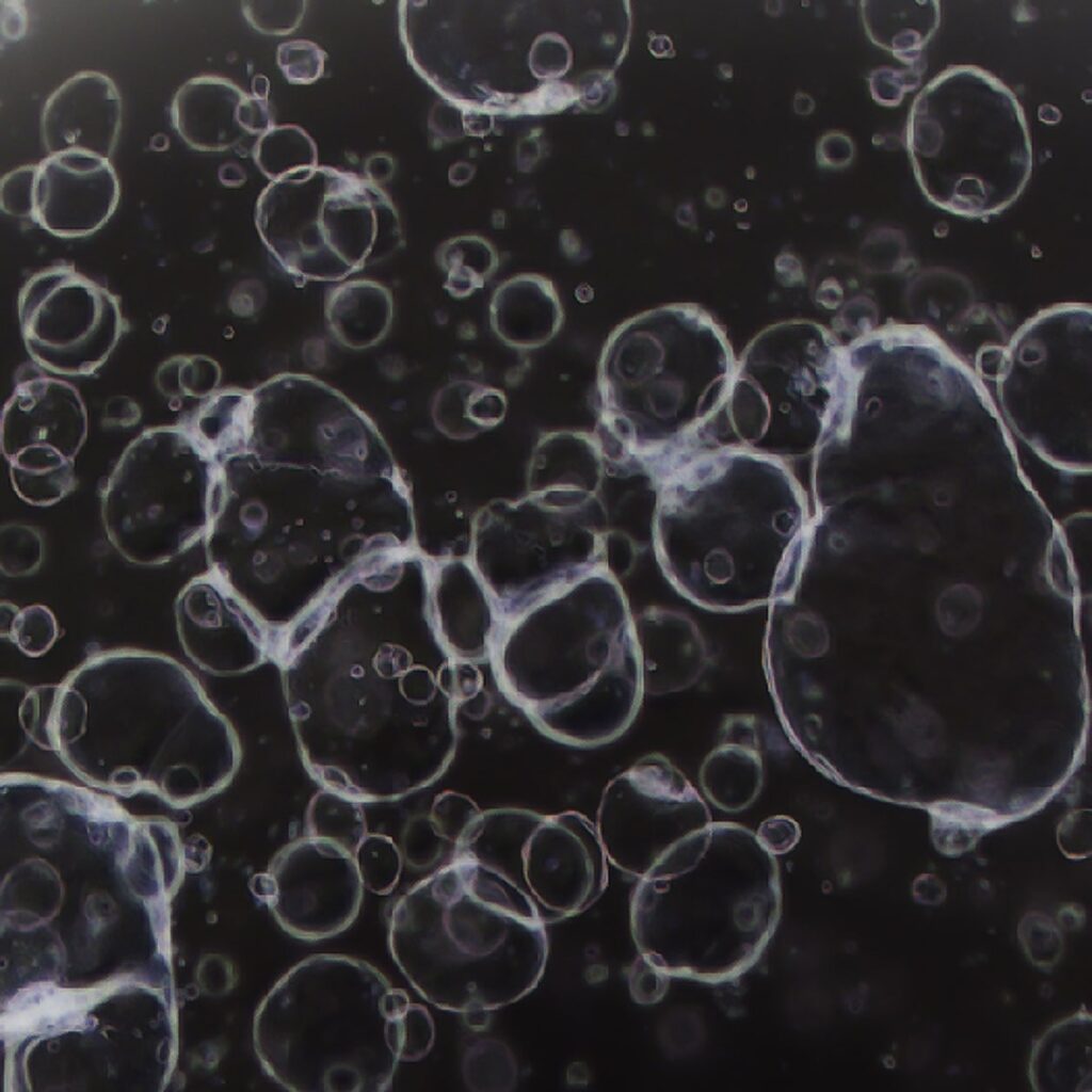 Hepatocellular Carcinoma Organoid - Lambda Biologics