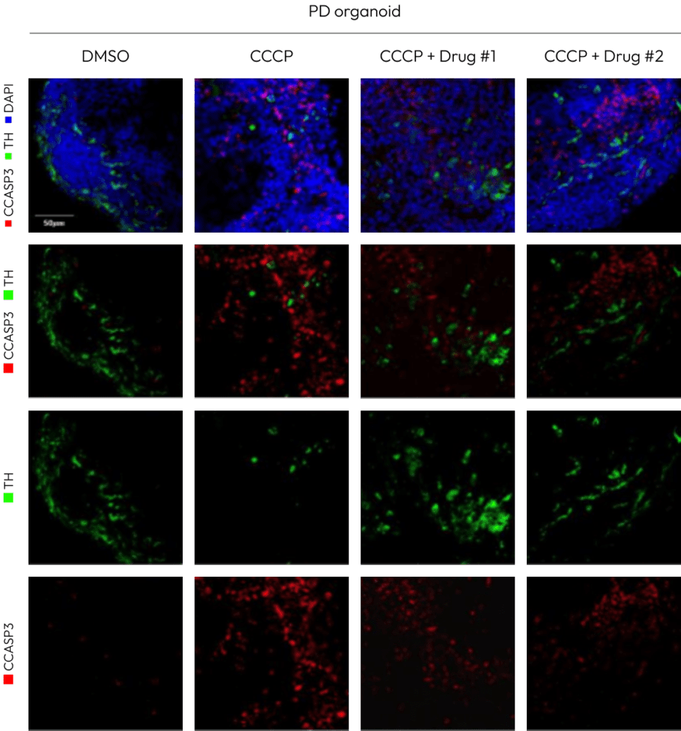 Midbrain Organoid - Lambda Biologics