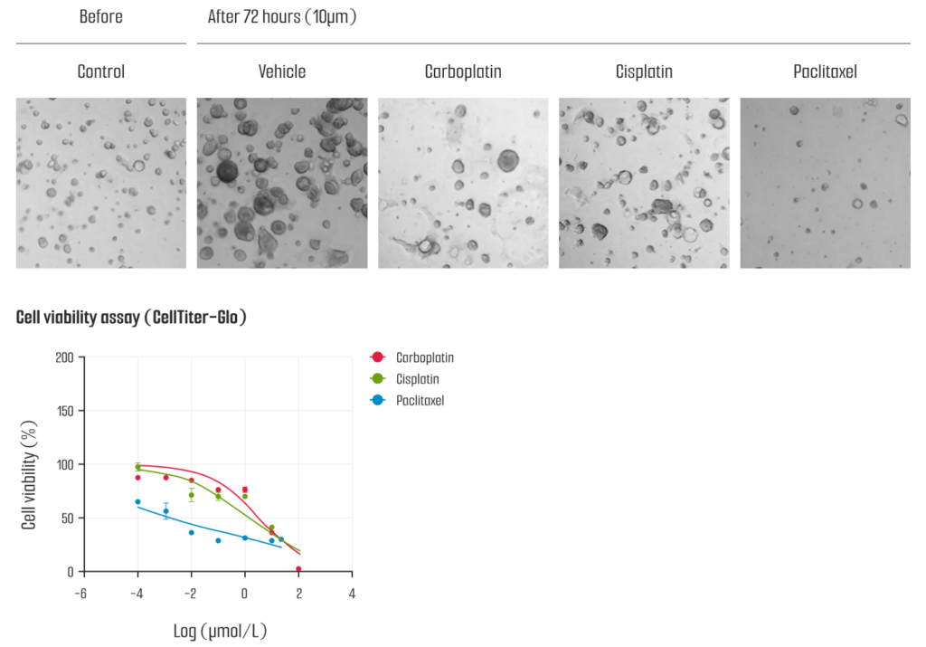 Breast Cancer Organoid - Lambda Biologics
