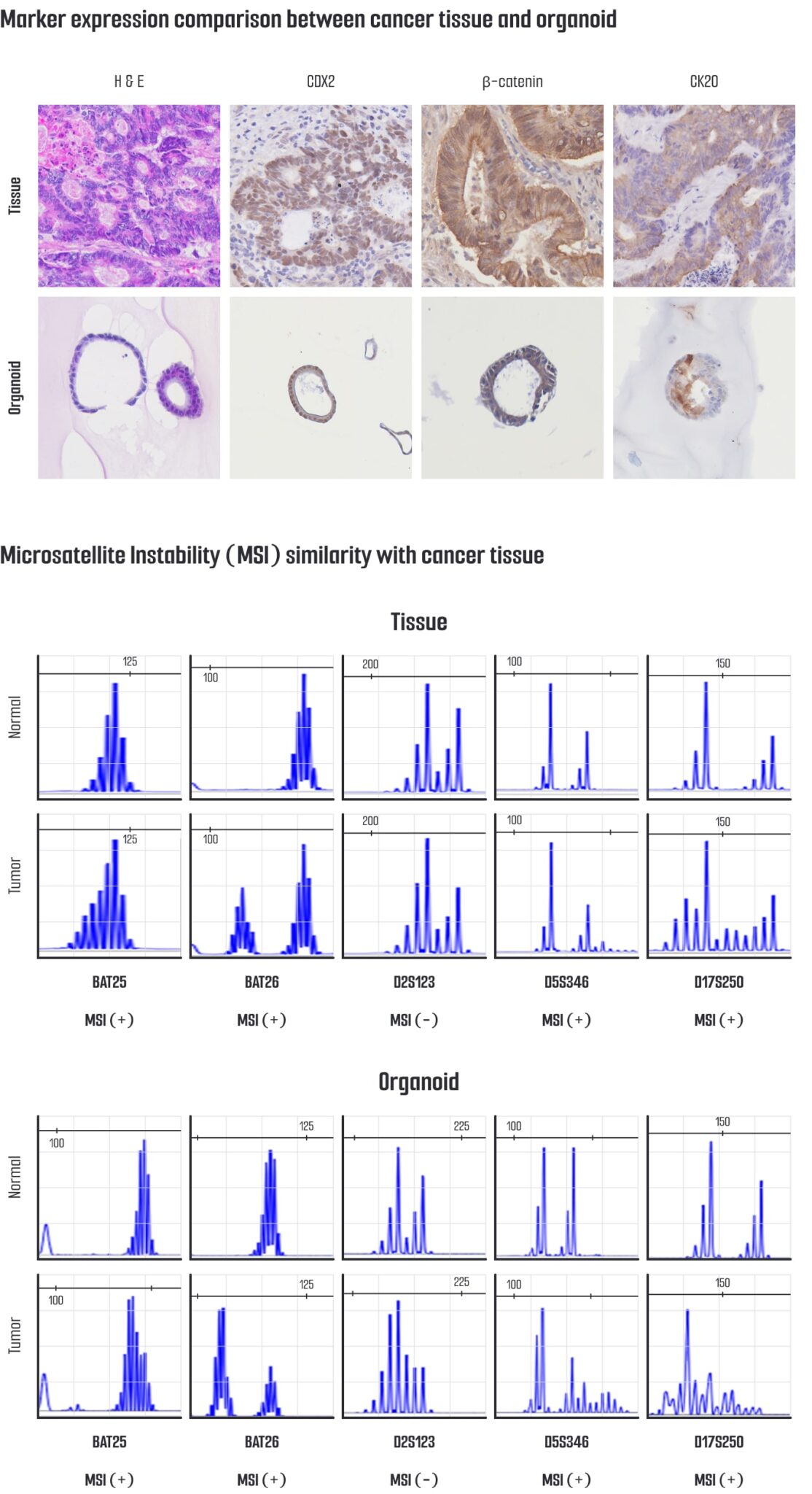 Colorectal Cancer Organoid - Lambda Biologics